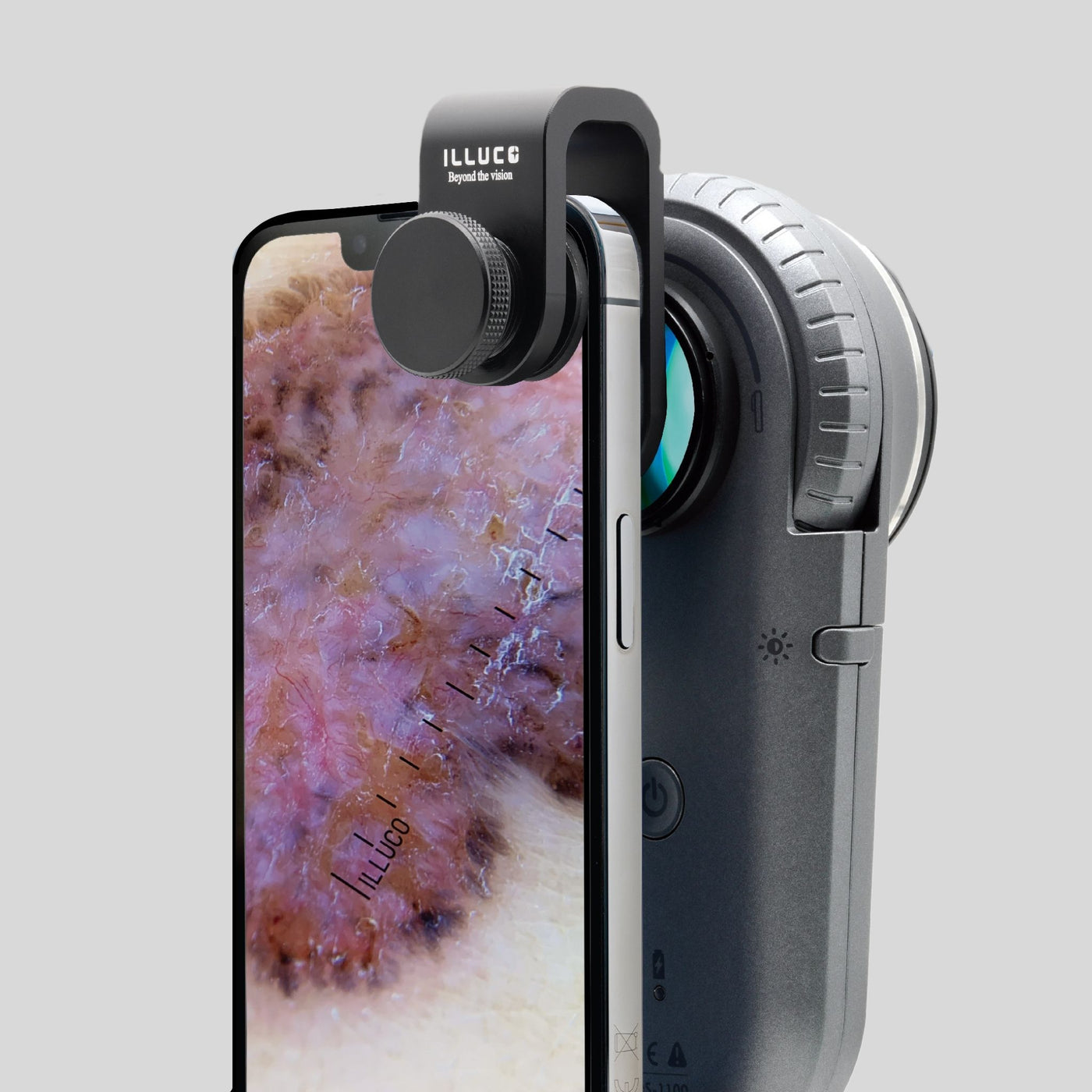 Universal Phone Clamp For ILLUCO Dermatoscope